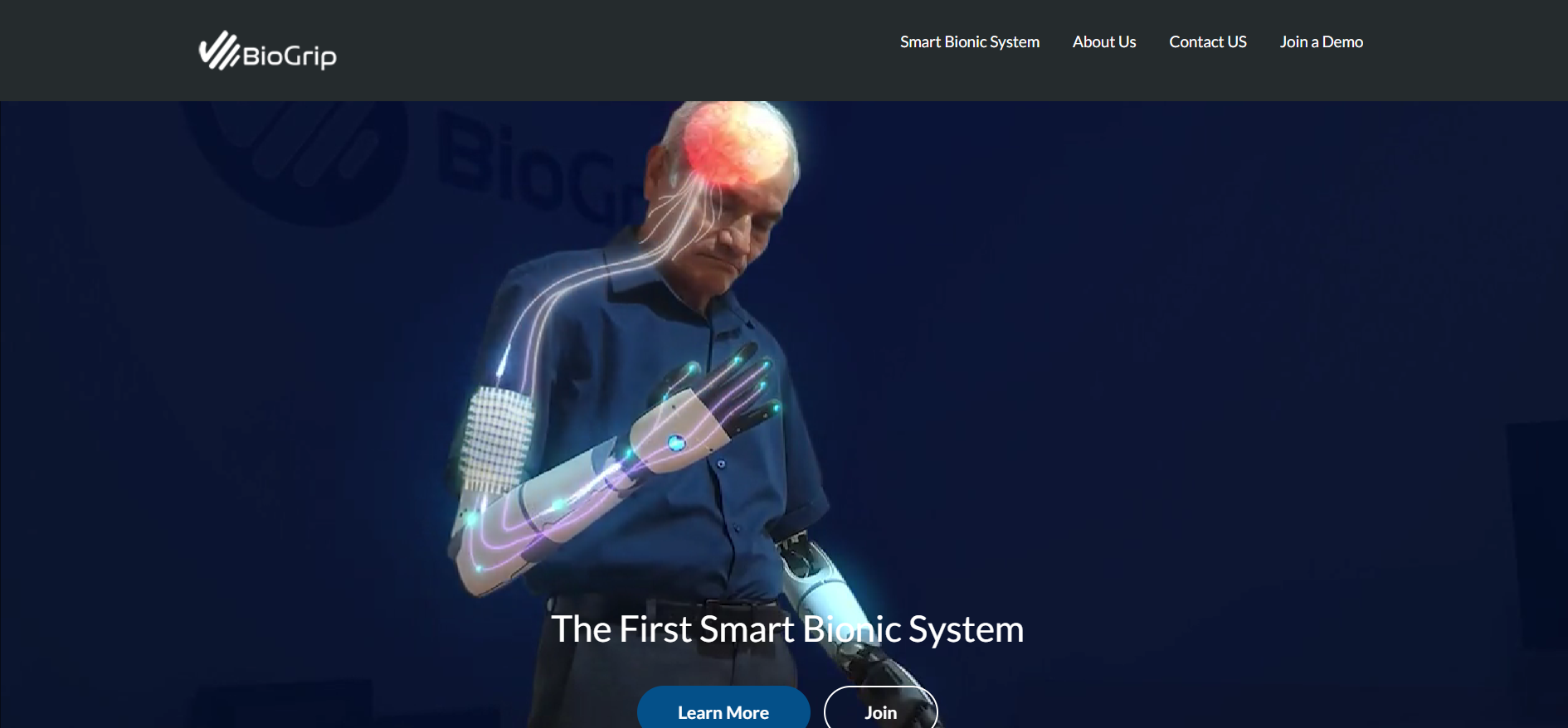 BioGrip: una startup que emplea IA en la industria biónica ...